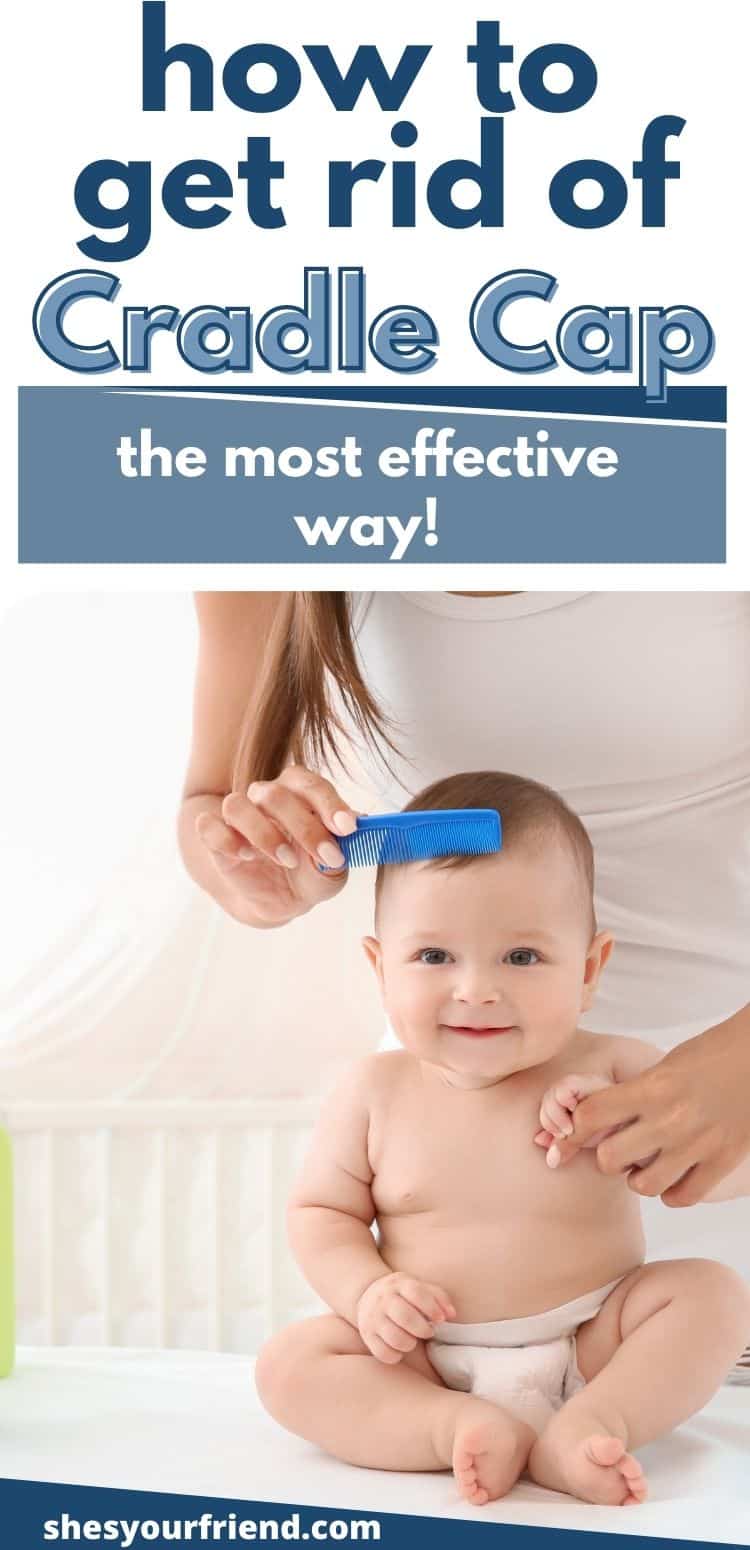 Complete guide to Cradle Cap and Baby - She's Your Friend